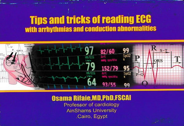 Tips and Tricks of Reading ECG : With arrhythmias and Conduction ...