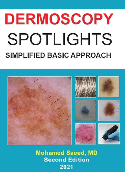 Dermoscopy Spotlights, 2e ABC Books